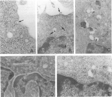 Visualization Of P Odn Uptake And Intracellular Trafficking By Electron