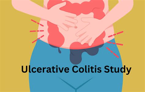 University Of Glasgow Seeking Volunteers With Ulcerative Colitis Registerforshare