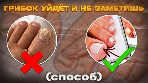 НЕУМЫВАКИН Все грибки вирусы и бактерии уйдут вместе с болезнями От грибка снаружи и внутри