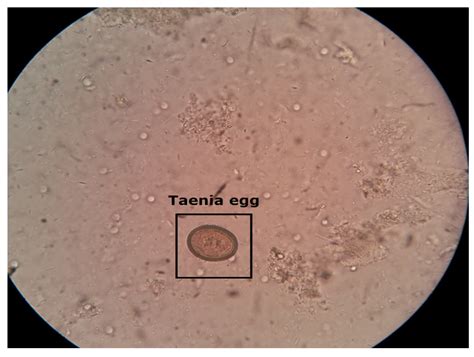 Parasite Egg In Stool