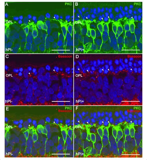 Synaptic Connectivity In The Retinal Outer Plexiform Layer OPL In Download Scientific