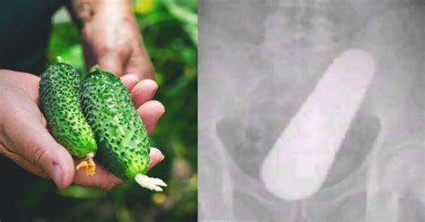 Bizarre Man With A Cucumber Stuck In His Behind