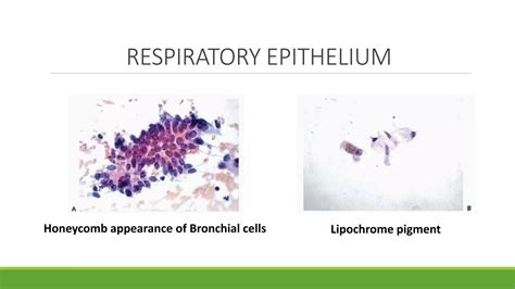 Bronchoalveolar Cytology Pptx