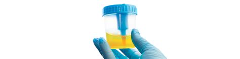 Doctor Answers Semen In Urine Bens Natural Health