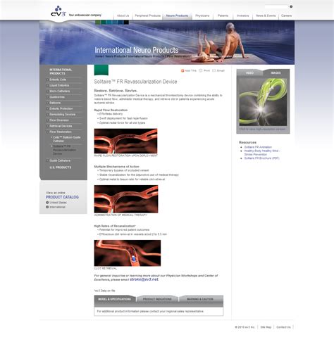 Mechanical Thrombectomy Using SOLITAIRE FR Stent System Science Of Neurointervention