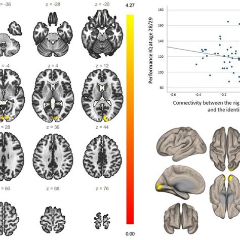 Functional Connectivity Of The Right Rostral Prefrontal Cortex And Its Functional Connectivity Of The Right Rostral Prefrontal Cortex And Its