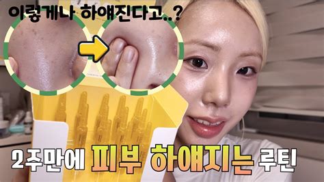 여름철 생겨난 기미 잡티 같이 케어해봐요🩵 피부 하얘지는 법 홈케어 미백제품 추천 Youtube