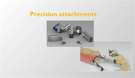 5 Precision Attachments In Prosthodontics Ppt Pptx