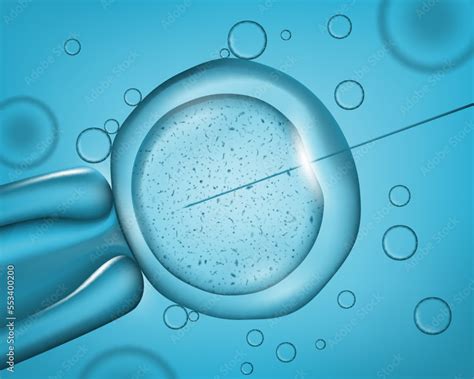 Laser Needle Injection To Cell Medical Operation Human Dna Research