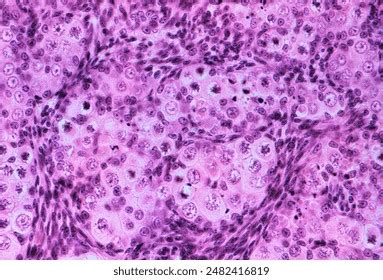 Sex Cord Stromal Cell Royalty Free Images Stock Photos Pictures Shutterstock