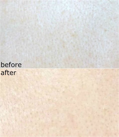 Cosrx Advanced Snail 96 Mucin Power Essence Review