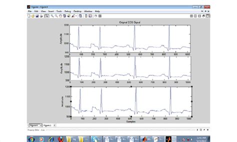 17 Comparison Of Gaussian And Klt Sensing Matrix Ecg104 With Cr41