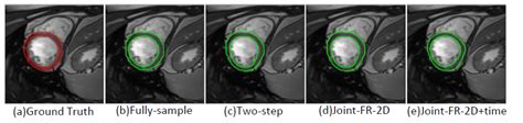 Joint Reconstruction And Segmentation