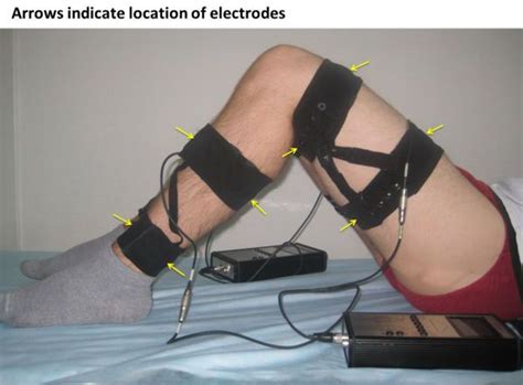 In Hospital Electrical Muscle Stimulation For Patients Early After Heart Failure Decompensation