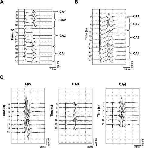 A Fluctuations Of Mep Amplitude During Complete Cataplexy Patient