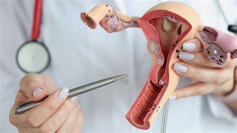 The Importance Of Endometrial Polyp Removal