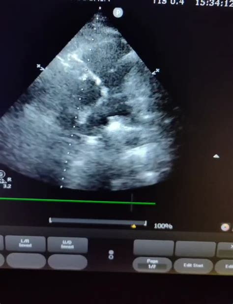 bincy varghese on linkedin nice 👍