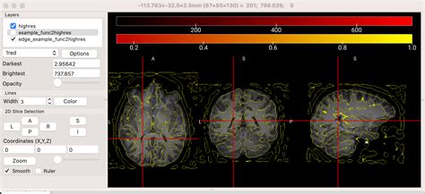 Mricrogl Tutorial 3 Viewing Images — Andys Brain Book 1 0 Documentation