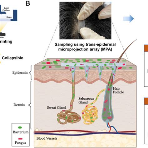 Design And Manufacture Of The 3d Printed Transepidermal Mpa And The Download Scientific Diagram