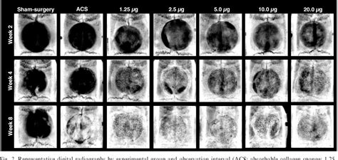 Effect Of Rhbmp 2 Dose On Bone Formation Maturation In A Rat Critical Size Calvarial Defect