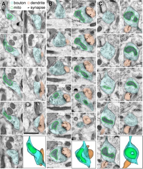 3d Reconstructions Of Serial Electron Micrographs Displaying Straight Download Scientific