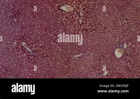 Liver Cell Microscope Stock Videos And Footage Hd And 4k Video Clips Alamy