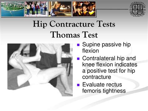 Rectus Femoris Contracture Test