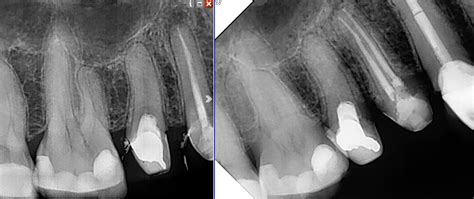Д р Пламен Славов Д р Пламен Славов стоматолог