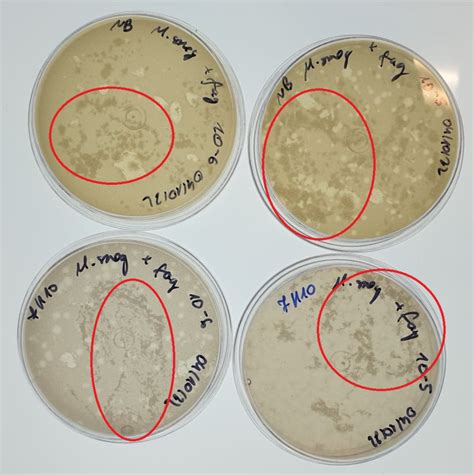 Plaque Assay Bacteria At Ginny Richter Blog