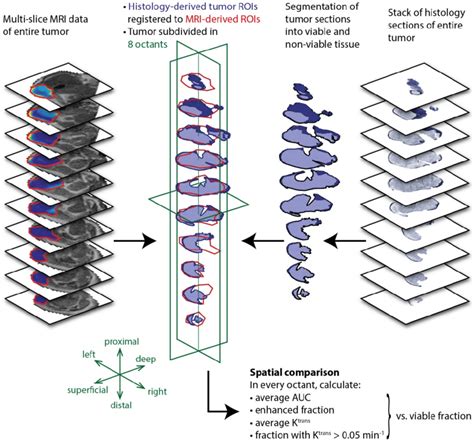 Data Processing Workflow For Spatial Comparison Of Dce Mri Data And Download Scientific Diagram