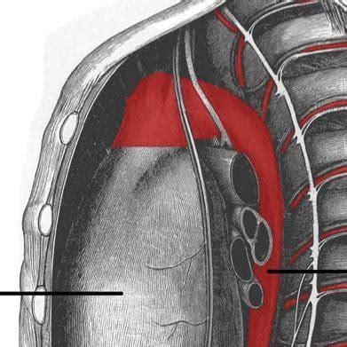 Aortic Dissection Classification Management Teachmesurgery