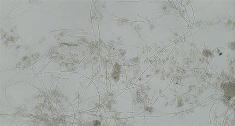 Filamentous Bacteria 水浄化フォーラム －科学と技術－