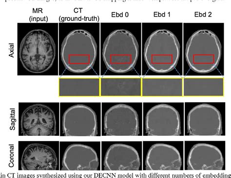 Figure 2 From Deep Embedding Convolutional Neural Network For