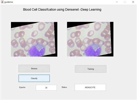 Blood Cell Classification Using Cnn Deep Learning Project