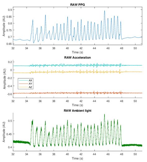 Ppg Accelerometry And Ambient Light Download Scientific Diagram