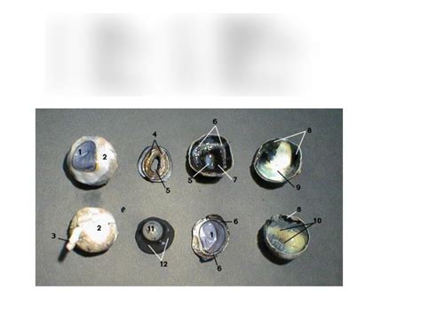 Diagram Of Eye Components Quizlet