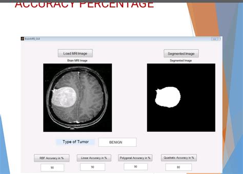 project brain tumor segmentation using kernal youth4work portfolios