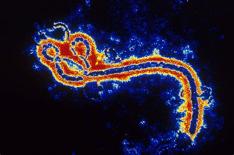 Ebola Returns To Sierra Leone After Three Weeks Free Time