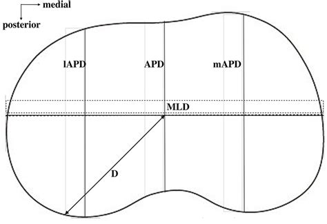 Different Dimensions On The Resected Tibial Surface Were Measured Mld Download Scientific