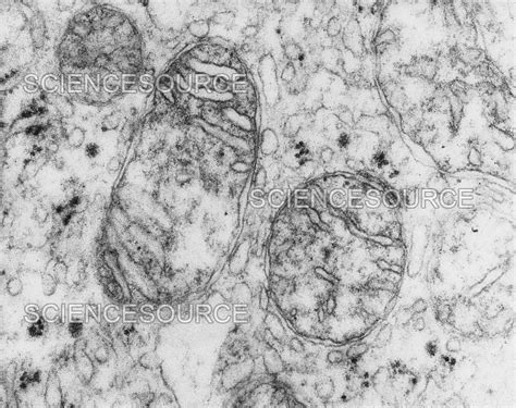 Smooth Endoplasmic Reticulum Electron Micrograph