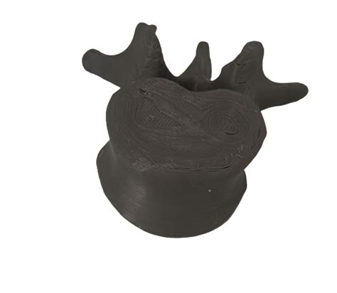 Stl File 3d Model Of The Humain Vertebra For Finite Element Simulation