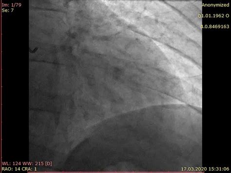 Pavel Somov On Linkedin Cto Pci Radialfirts Fielder Des