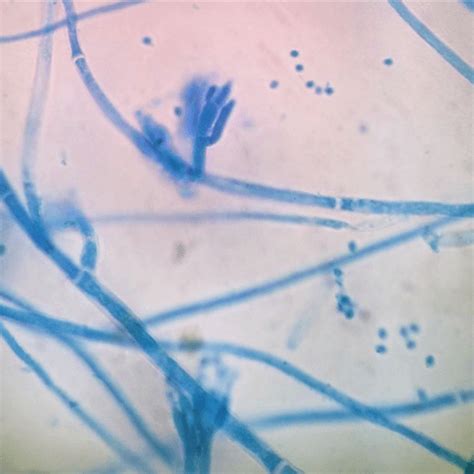 Fungi In Cleanrooms Types Origins And Decontamination Strategies