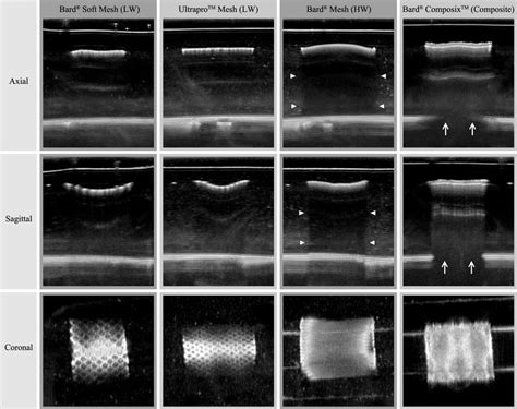 Abus Imaging Comparisons Of Four Tested Meshes The Four Columns Show