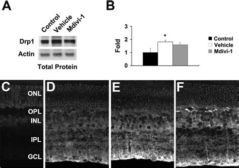 Drp1 Expression In Ischemic Retina After Mdivi 1 Treatment Drp1 Download Scientific Diagram