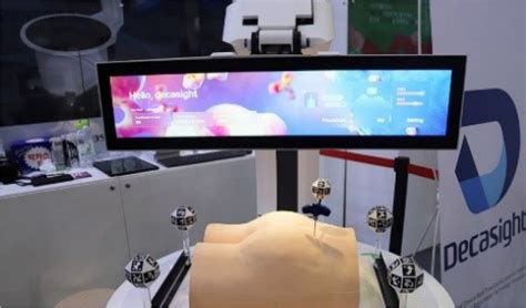 Surgical Navigation Solution Korean