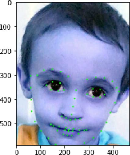 Figure 15 From Federated Machine Learning For Multi Aspect Neuro Developmental Disorders Autism