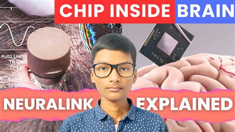 Control Anything With Your Brain How Neuralink Works Merging Brain With Ai Neuralink