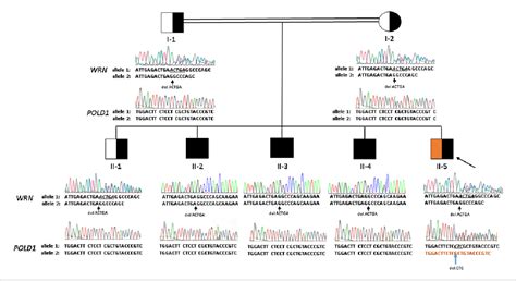 Figure 1 From A De Novo Pold1 Mutation Associated With Mandibular