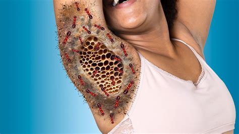 Asmr Animation Treatment From Infected Armpit Asmr Treatment